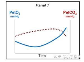 运动处方制定必备技能之心肺运动试验（CPET）— — 基本概念与九图解读 - 知乎