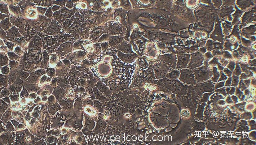 细胞学堂|Caco-2人结直肠腺癌细胞的生长特性及常见问题 - 知乎