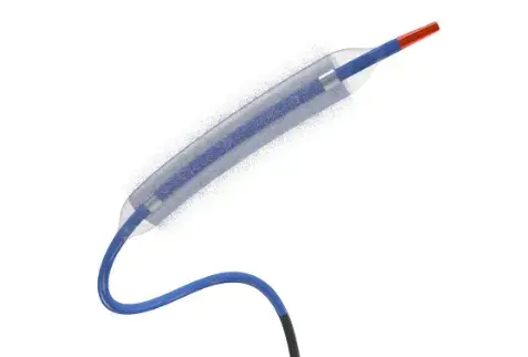 波科AGENT药球2年结果：治疗支架内再狭窄优于球囊血管成形术 - 知乎