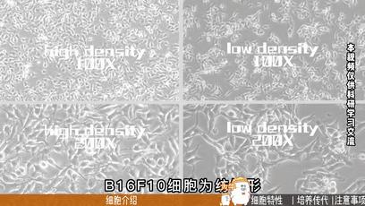 B16F10细胞培养，小鼠黑色素瘤细胞培养攻略-丰晖生物 - 知乎