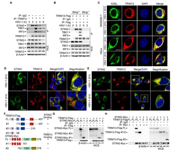 IF:13.6|E3酶的新作用—抑制致病DNA引发的炎症反应 - 知乎