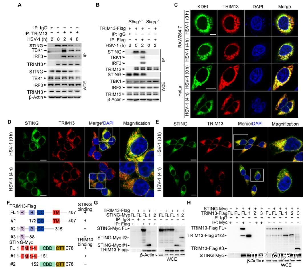 IF:13.6|E3酶的新作用—抑制致病DNA引发的炎症反应 - 知乎