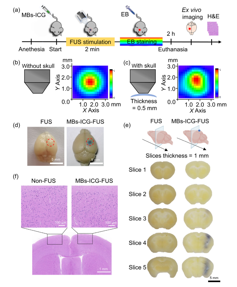 纳米材料 | 超声诱导以打开血脑屏障的 NIR-II 荧光可视化，用于使用ICG吲哚菁绿微泡增强光热治疗胶质母细胞瘤 - 知乎
