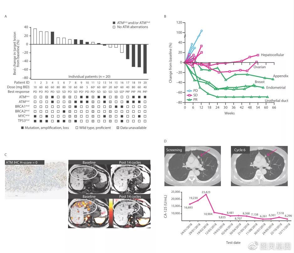 Cancer Dis | 靶向DNA修复药物阻止肿瘤生长，并有良好的耐受性 - 知乎