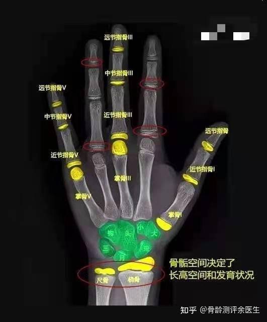 中华05，TW3，G-P图谱法，该相信谁？ - 知乎