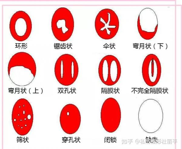 女性阴部的形态，一定要是 小且紧”，才算正常、健康形态吗？ 知乎