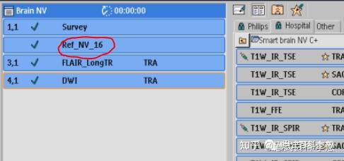 磁共振中非常重要但是又看不到的预扫描Pre-scan - 知乎