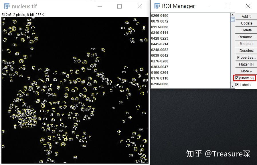 ImageJ实用教程——基于深度学习的细胞核自动分割（插件篇） - 知乎