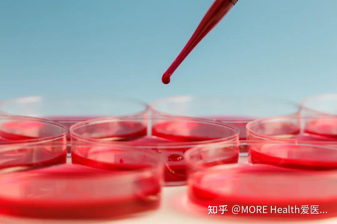 新药 | 美国FDA批准首款β-地中海贫血基因疗法Zynteglo上市 - 知乎