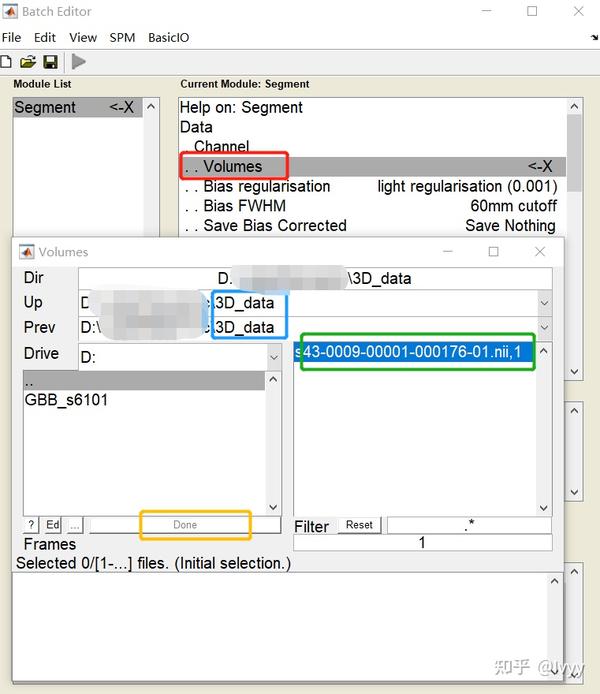 SPM数据预处理 -单被试 - 知乎