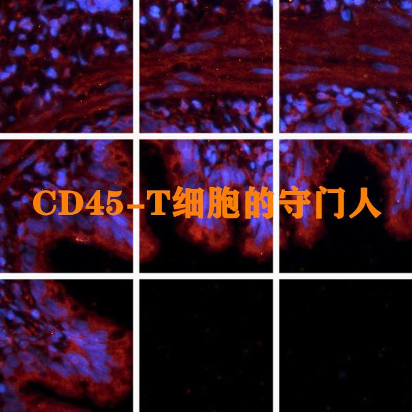 CD45-T细胞守门人 - 知乎