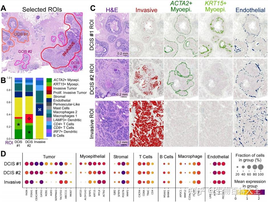 Xenium空间原位分析高端局—从文献解析到研究思路大揭秘 - 知乎