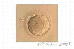 胚胎受精（有效区分0PN，1PN，2PN，3PN/4PN） - 知乎