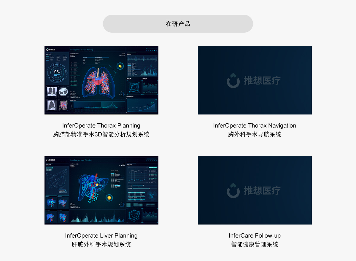 医疗公司：推想医疗 - 知乎
