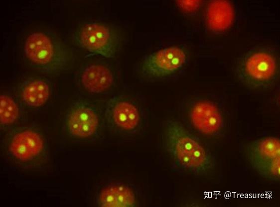 ImageJ实用技巧——荧光共标细胞计数(解放双手篇) - 知乎