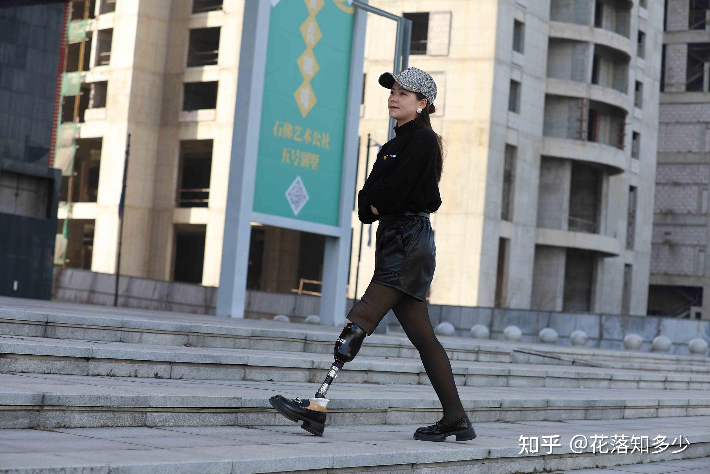 截肢后的主要功能障碍及治疗方法 知乎