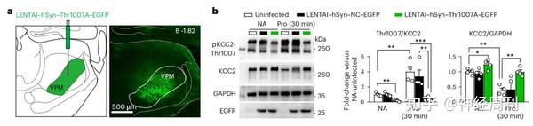 科学家揭示全身麻醉神秘失忆之谜：KCC2蛋白泛素化或成关键突破口 - 知乎
