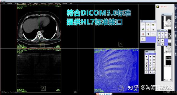 大型医院影像PACS系统三维重建技术（获取数据、预处理、配准、重建和可视化） - 知乎