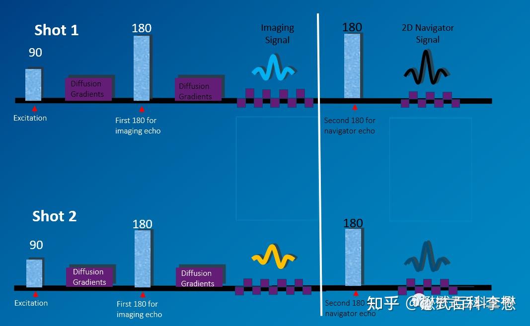 IRIS：多激发SE-EPI扩散（弥散）序列 - 知乎