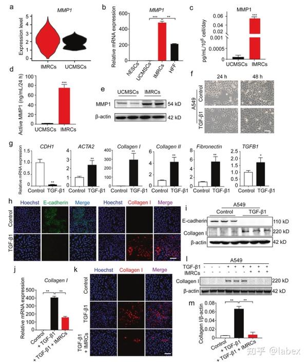 文献分享：IMRCs治疗肺损伤和纤维化的潜力 - 知乎