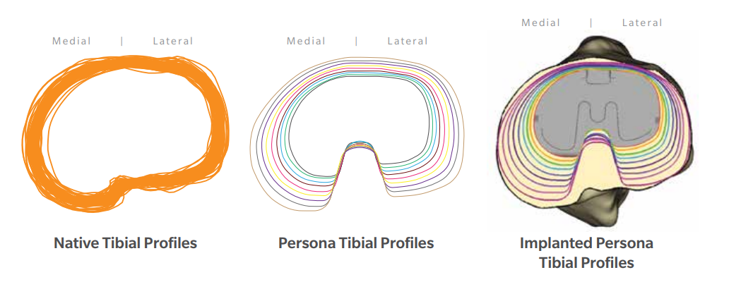 突破性合作！骨科巨头与手持微型机器人 - 知乎