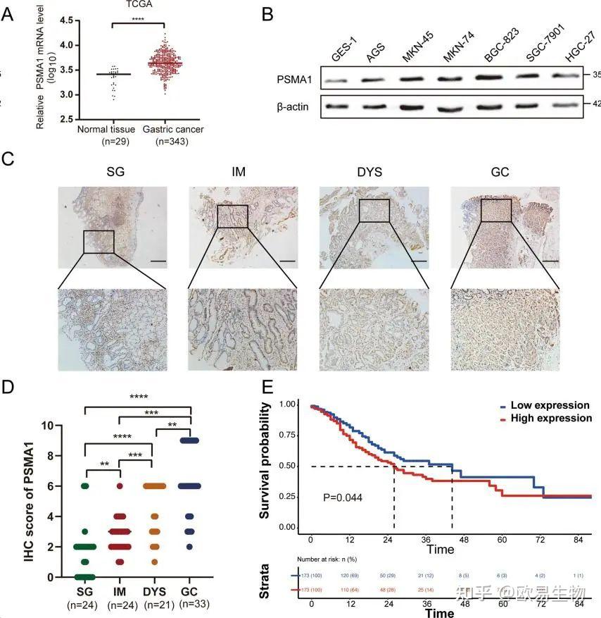 生物学一区TMT标记定量蛋白组学探究胃癌发展潜在机制 - 知乎