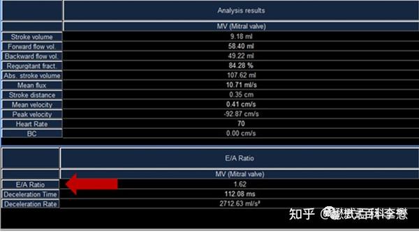 什么叫E/A ratio E/A比值 - 知乎