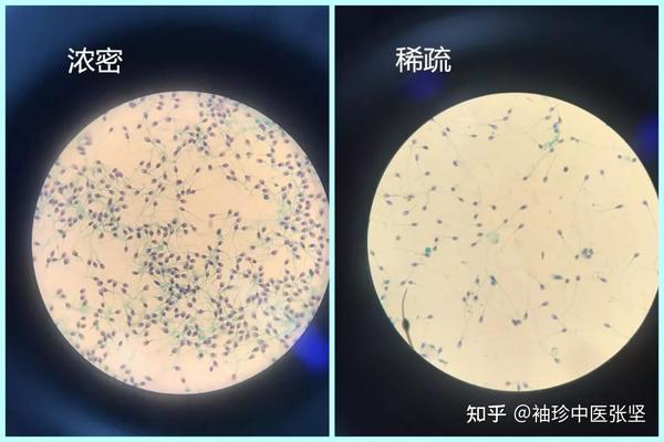 精如其人||微观真实世界的探索——显微镜下精子观察 - 知乎