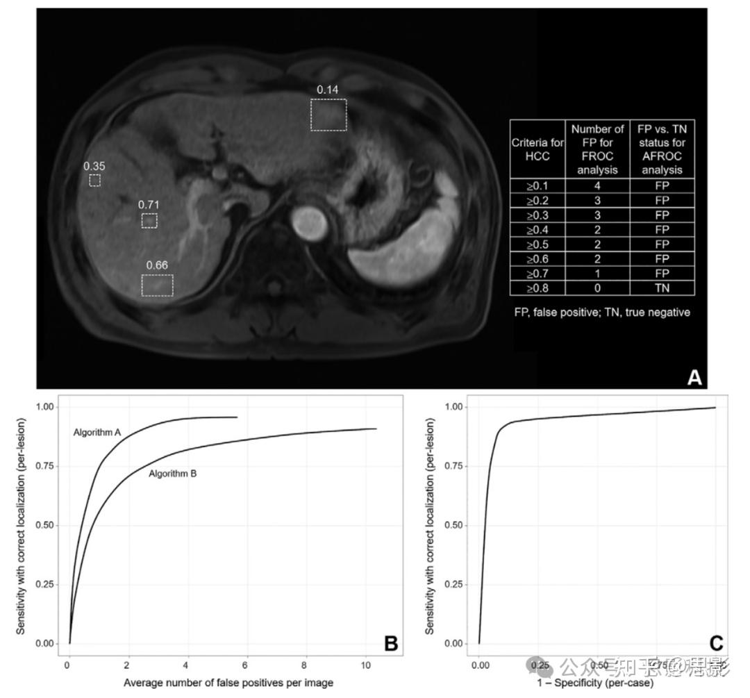 Radiology：医学诊断人工智能算法的临床评估方法 - 知乎