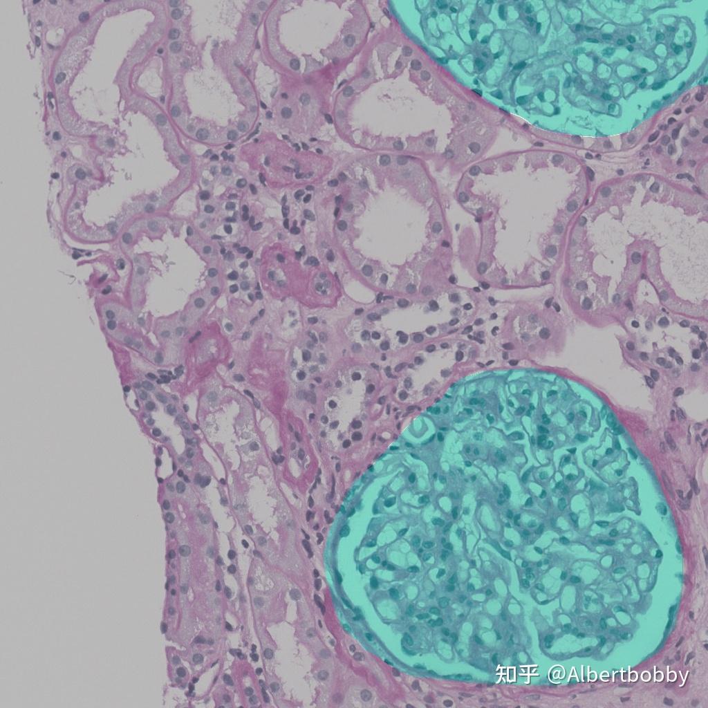 OpenMMLab打卡笔记（7）--MMSegmentation代码教学 - 知乎