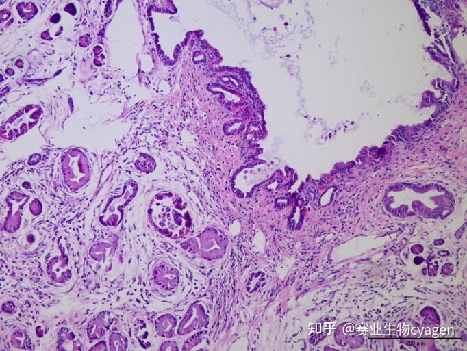 热门推荐｜自发性肿瘤小鼠——药物研发的好帮手 - 知乎