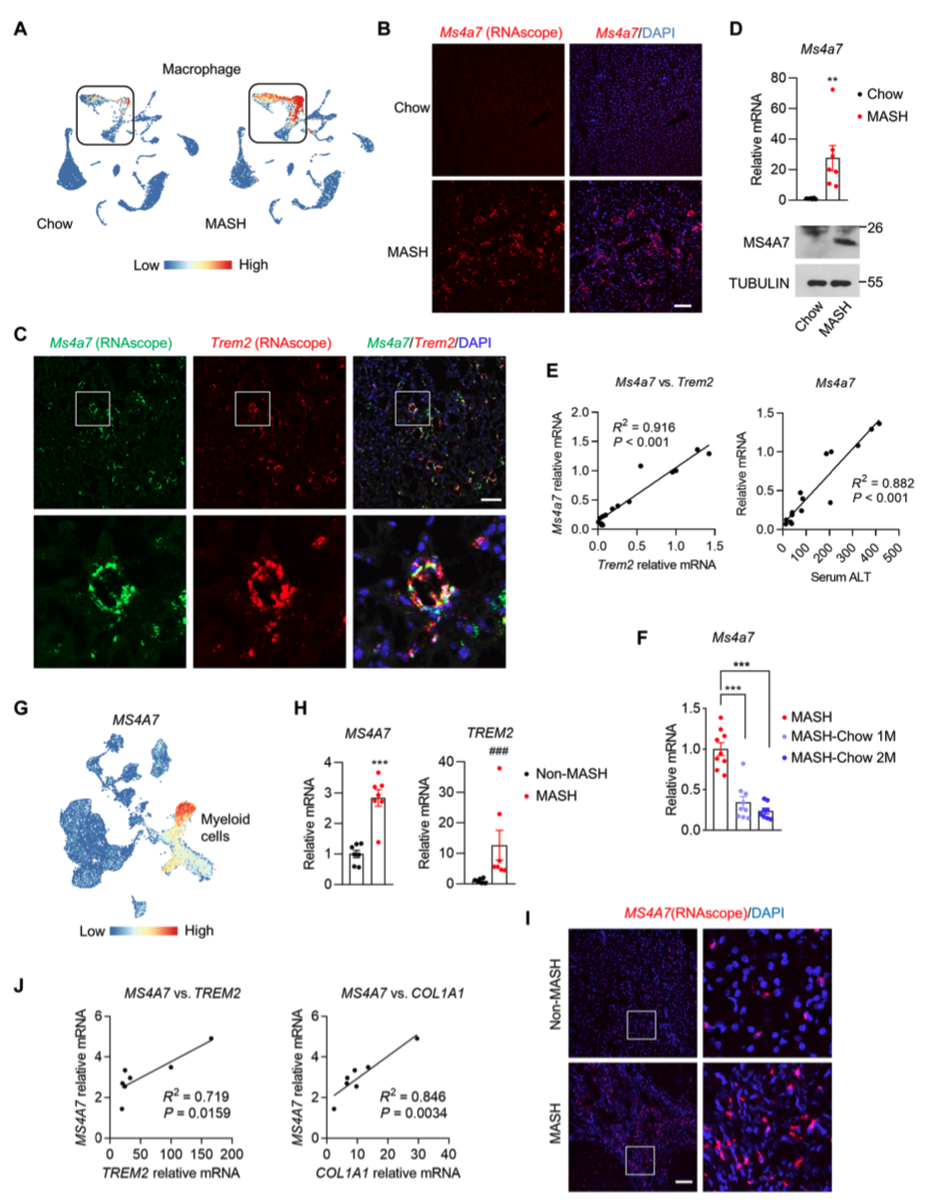 Science子刊丨肝脏危险信号诱导 TREM2+ 巨噬细胞，并通过 MS4A7 依赖性炎症小体激活驱动脂肪性肝炎 - 知乎