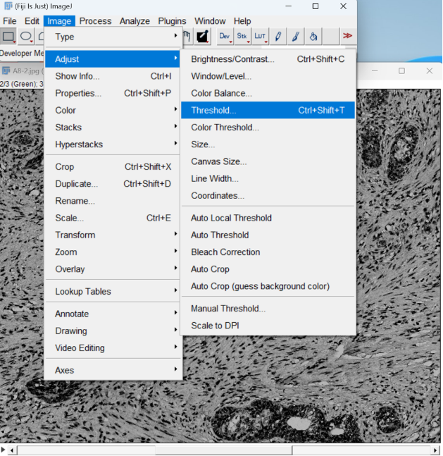 解忧小工具｜保姆式教程！用Image J进行免疫组化分析（IHC score评分） - 知乎