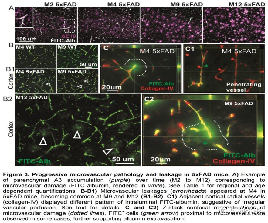5xFAD（五转）五转家族性阿尔茨海默病模型小鼠 - 知乎