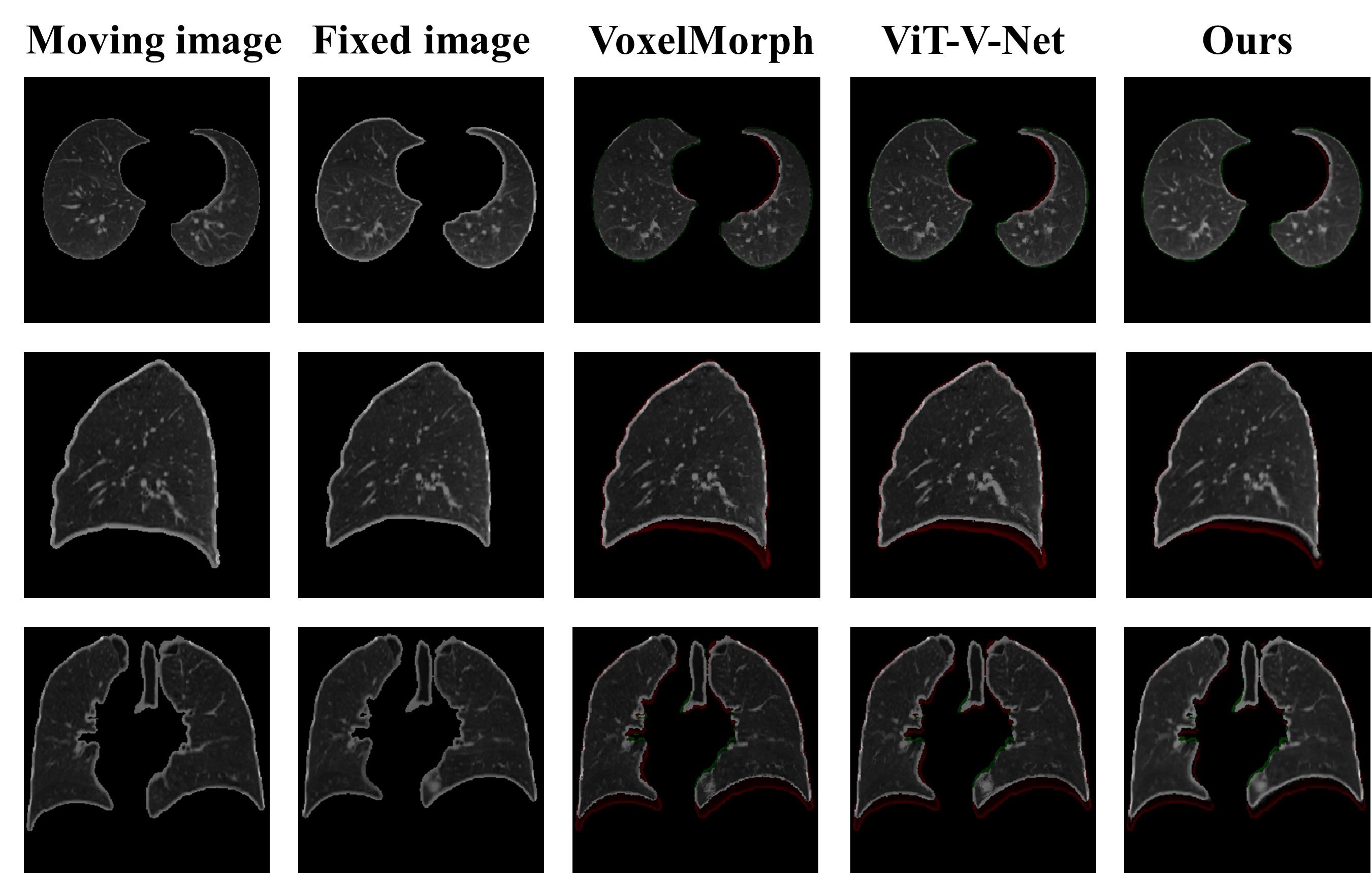 Spatial Transformer Networks与Landmark - 知乎