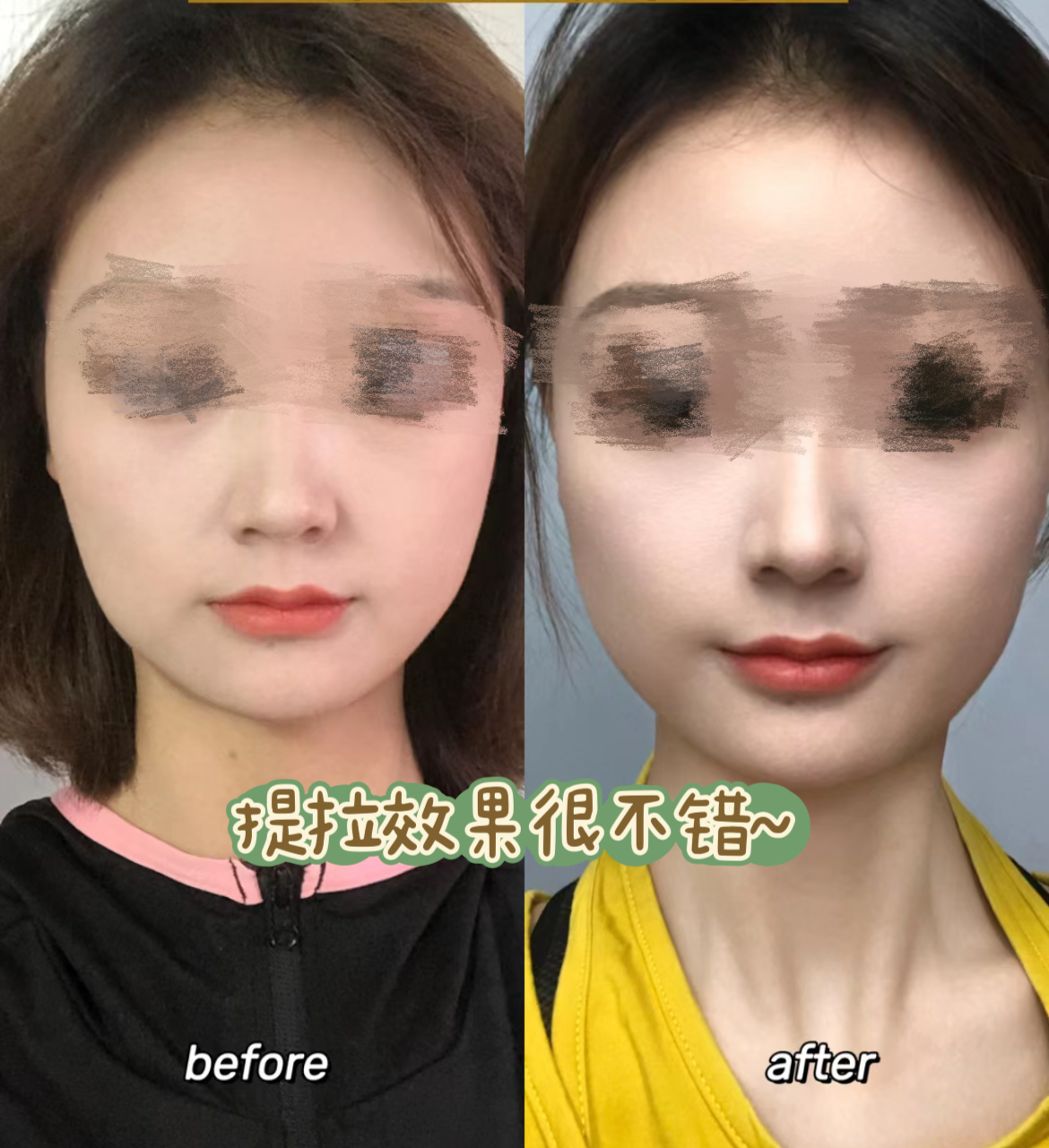 美容仪真的是智商税吗？如何入手合适的美容仪？优秀美容仪种草推荐！（GEMO金茉/Amiro Pro Max /CFCF M6-PLUS）