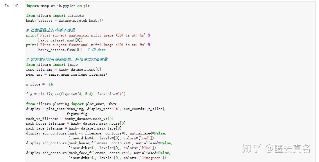 nilearn 笔记（5） - 知乎