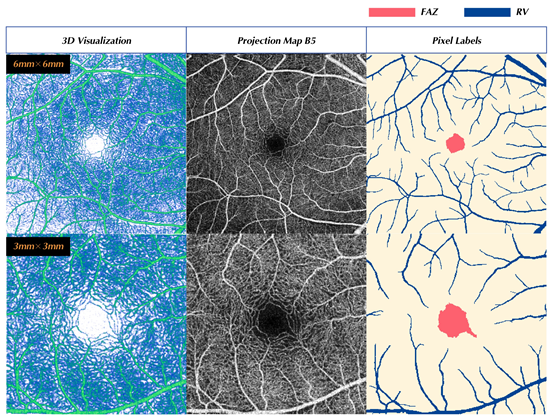 80GB医学影像数据集！OCTA-500公开发布 - 知乎