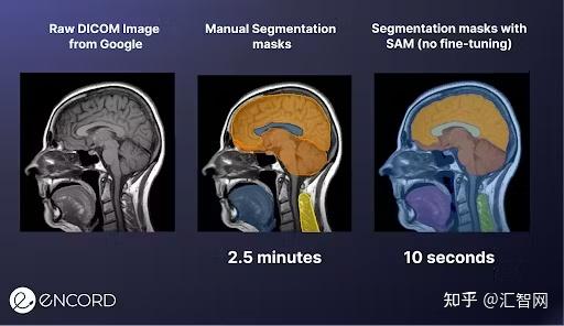 用SAM分割任意图像【AI大模型】 - 知乎