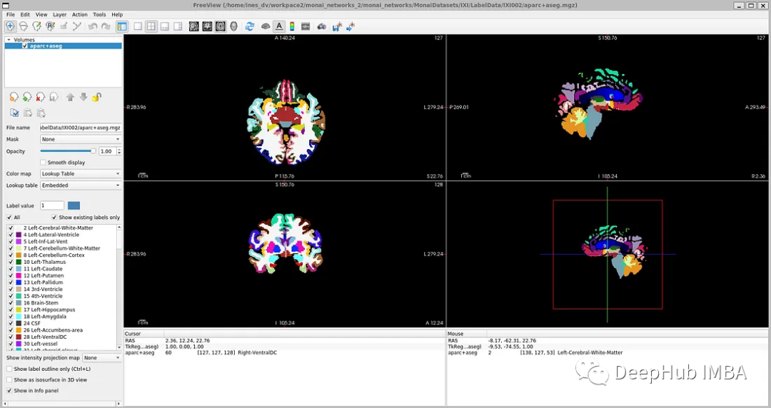 实践教程｜使用Pytorch对MRI脑扫描的图像进行分割 - 知乎