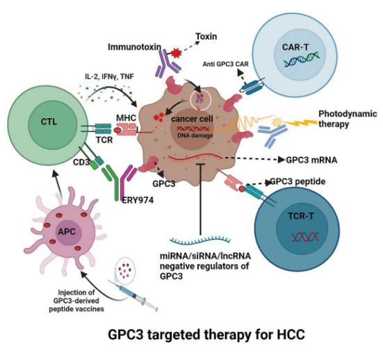 细说肝癌治疗潜力靶点--GPC3 - 知乎