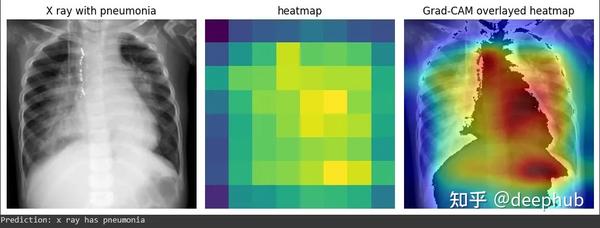 Grad-CAM的详细介绍Pytorch代码实现 - 知乎