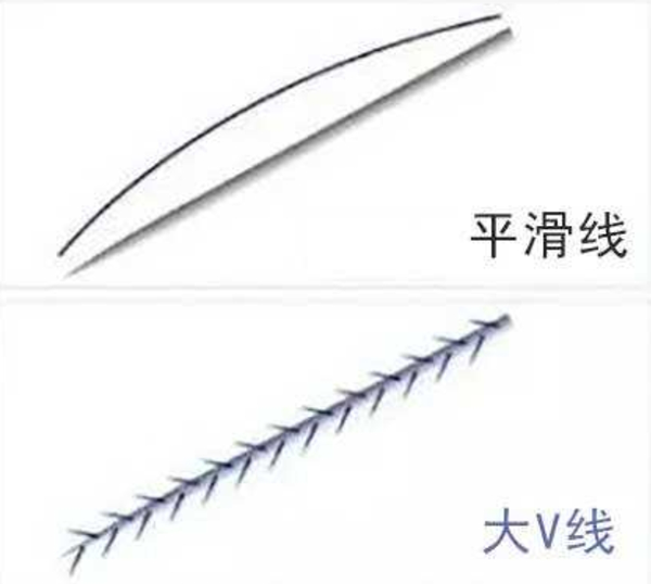 线雕科普：“大V线”&“小V线” - 知乎