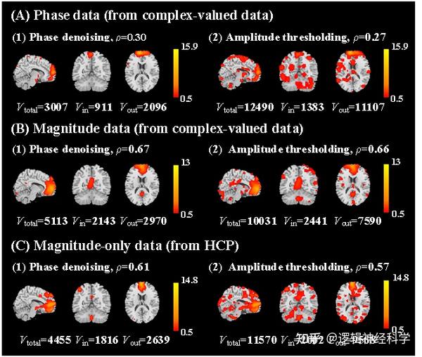 Hum Brain Mapp︱大连理工大学林秋华课题组为fMRI幅值脑网络生成了相位信息并用于统一阈值的高性能消噪 - 知乎