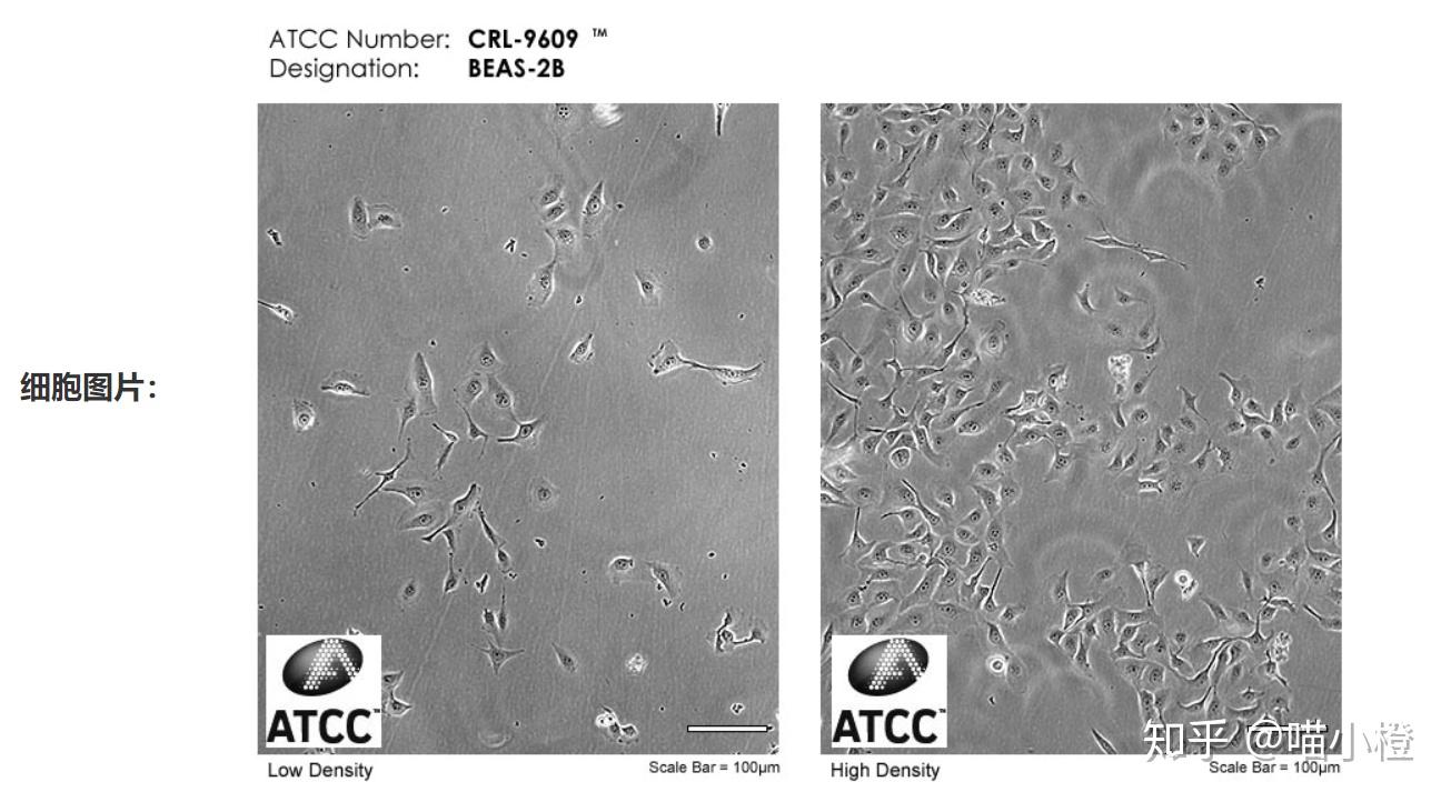 BEAS-2B（人肺（支气管）上皮细胞） - 知乎