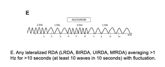 王群教授：2021重症脑电图监测术语更新！ - 知乎