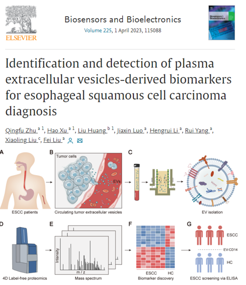Biosensors & Bioelectronics | 温州医科大学刘飞团队: 用于食管鳞癌诊断的血浆EV生物标志物的鉴定和检测 - 知乎