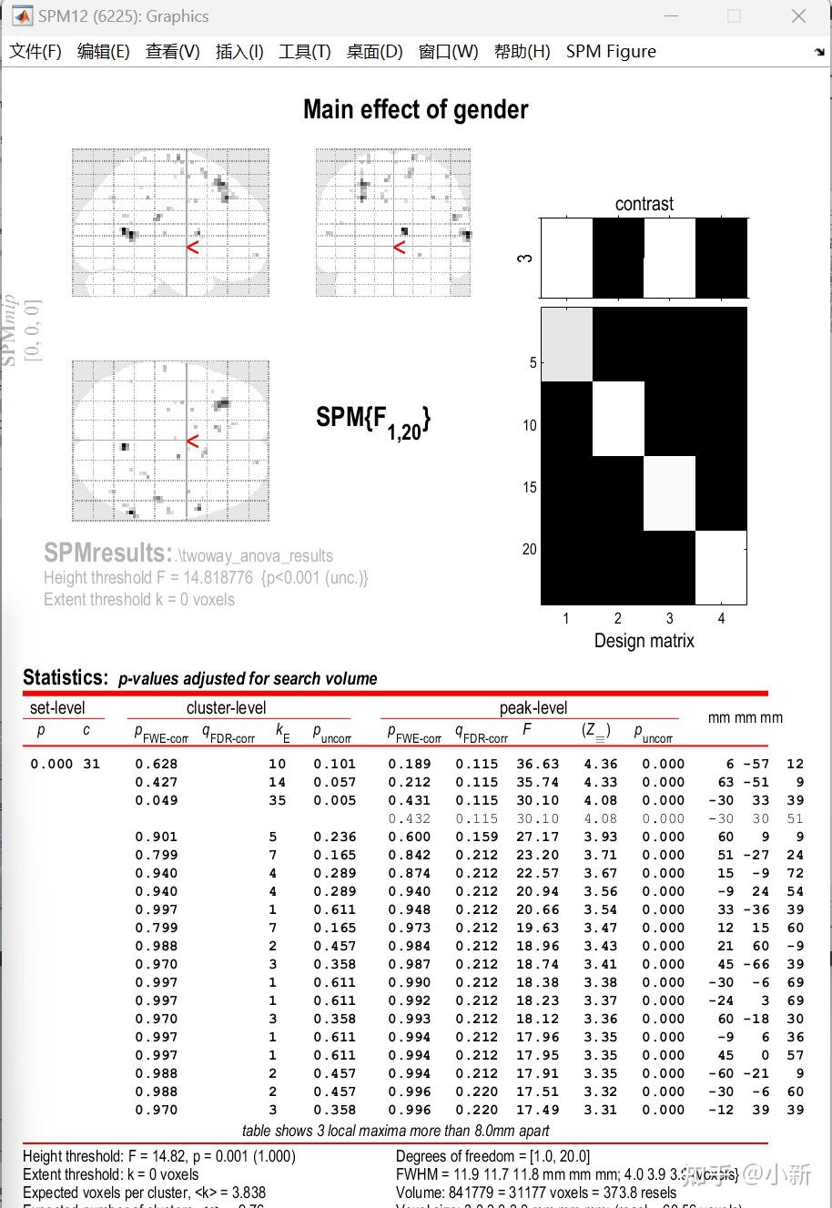 13-SPM-fmri任务态 二阶分析：多因素方差分析 - 知乎