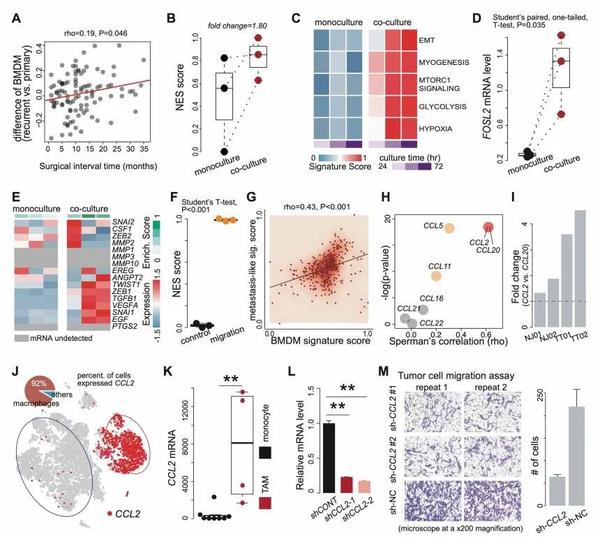 Cancer Discov | 胶质母细胞瘤中肿瘤与免疫环境的自然协同进化 - 知乎