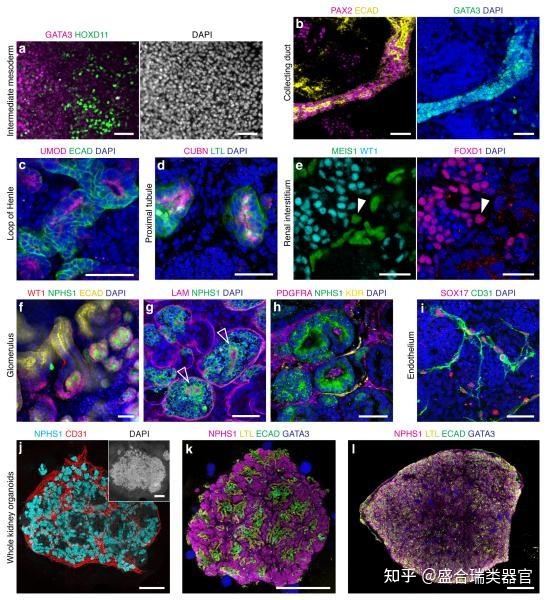 【Nature Protocol】系列：从hPSC中生成肾脏类器官方案（上） - 知乎